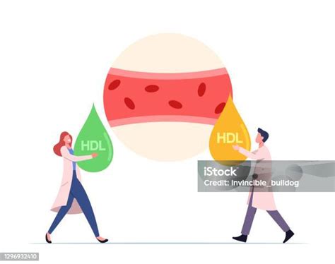 건강 관리 개념 좋은 나쁜 Hdl 콜레스테롤 방울을 들고 거대한 인간의 혈액 동맥에서 작은 메딕 문자 개념에 대한 스톡 벡터