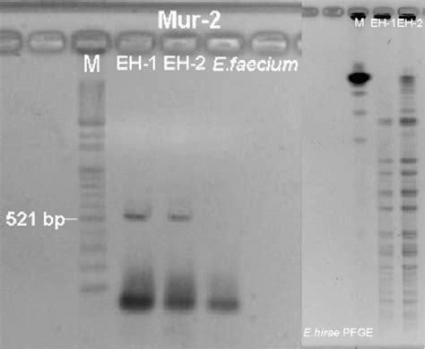 A Polymerase Chain Reaction Of The Two Enterococcus Hirae Strains Download Scientific Diagram