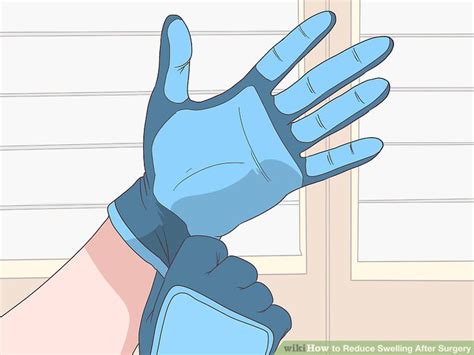 3 Ways To Reduce Swelling After Surgery Wikihow