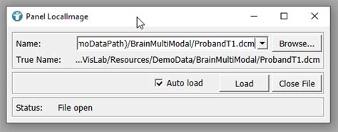 Example 3 Iterative Tests In Mevislab With Screenshots