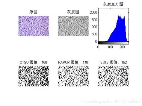 【图像分割】基于matlab Tsallis熵算法灰度图像分割【含matlab源码 715期】 Csdn博客