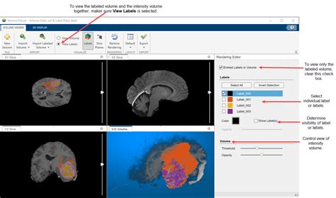 Explore 3 D Labeled Volumetric Data With Volume Viewer Matlab And Simulink