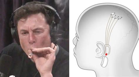 Elon Musk Says People Will Eventually Consume Music Through Brain Chip