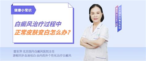 白癜风治疗新技术：白癜风治疗过程中，正常皮肤变白怎么办？ 哔哩哔哩