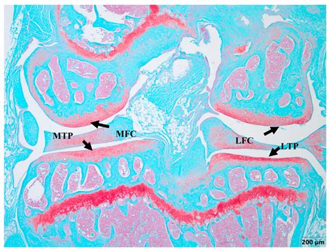 Safranin O Staining Of Healthy Cartilage Mfc—medial Femoral Condyle