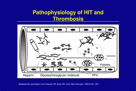 Ppt Understanding Heparin Induced Thrombocytopenia Hit Historical