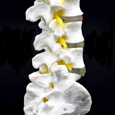 Medical Human Lumbar Spine Demonstration Model Anatomical Model Lumbar