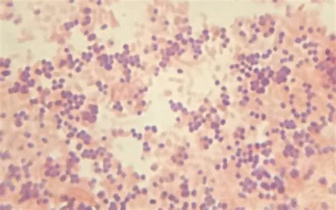Visualizing Bacterial Morphology A Guide To Gram Staining