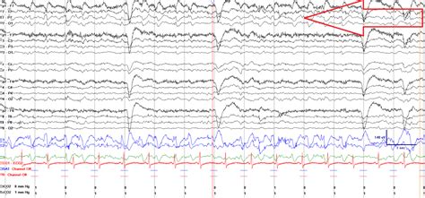 Gallery The Eeg Game