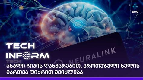 ახალი ჩიპის დახმარებით პროთეზული ხელის მართვა ფიქრით შეიძლება Youtube