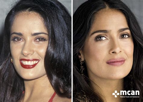 Salma Hayek Plastic Surgery Before And After Salma Hayek Plastic