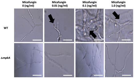 Hyphal Morphology Following Exposure To Micafungin The Morphology Of
