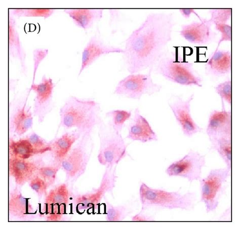 Lumican Staining In Human Iris Pigment Epithelial Cells Ipe And Iris