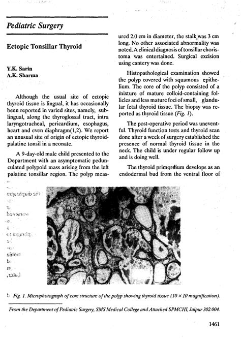 Pdf Ectopic Tonsillar Thyroid