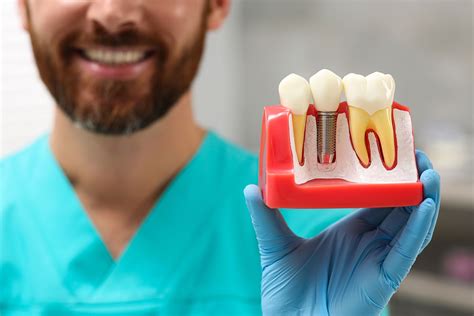 Periodontist In Houston Tx Dr Friedberg And Associates