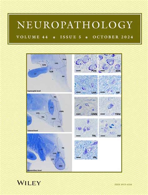 The Predominance Of “astrocytic” Intranuclear Inclusions In Neuronal