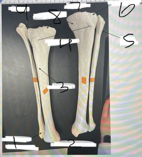 Tibia And Fibula Flashcards Quizlet