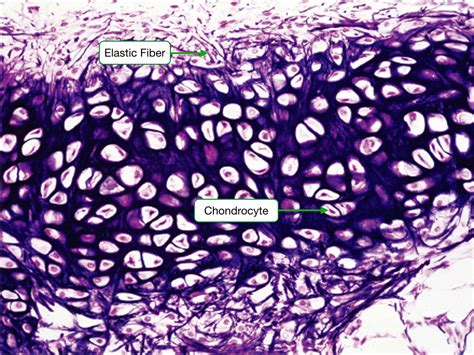 Structure And Function Of Connective Tissue And Bone Lab