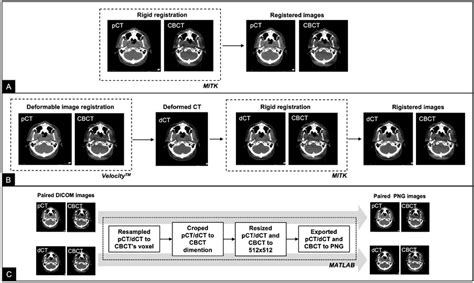 Flowchart Of The Data Preparation Process A Pct Was Registered To Download Scientific