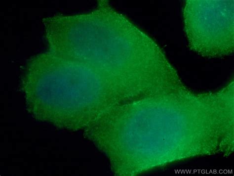 Rhoa Antibody 66733 1 Ig Proteintech