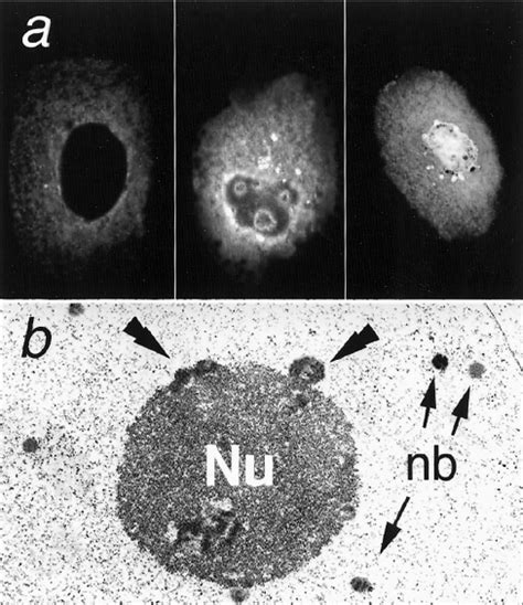 Nuclear Localization Of C Terminally Truncated Fmrp In Transfected