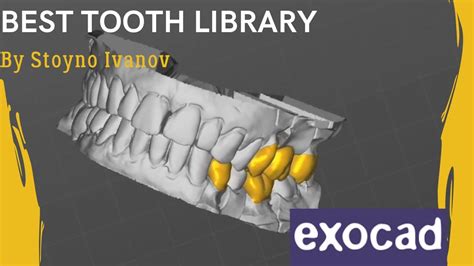 Fastest Exocad Video Tutorial Best Tooth Library Design Youtube