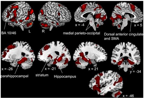 Pattern Of Brain Activations In All Subjects When Encoding Intentions