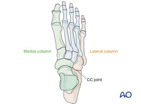 Nonoperative Treatment For Cuboid Avulsion Fracture