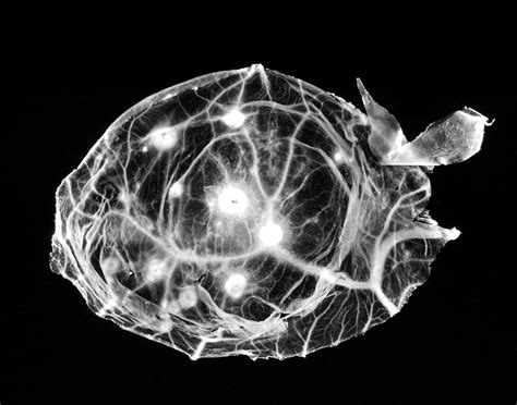 Free Picture Smallpox Virus Chorioallantoic Membrane Developing