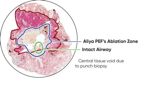 Aliya System Galvanize