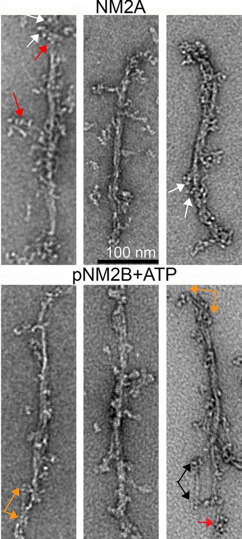 Polymerization Pathway Of Mammalian Nonmuscle Myosin 2s Pnas
