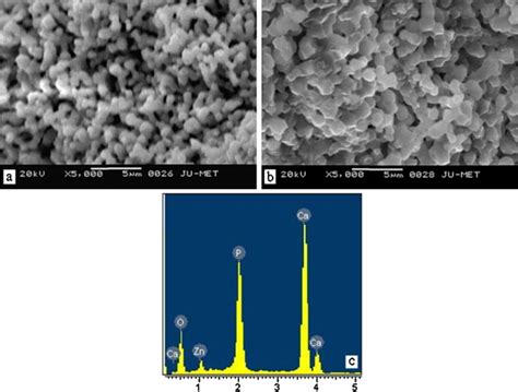 SEM Micrograph Of A Pure HAp And B Doped HAp C EDX Pattern Of Download Scientific