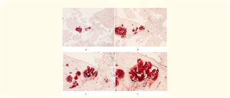 legends to figure 12a 12d same as figure 9a 9d 1727 2016 synovial