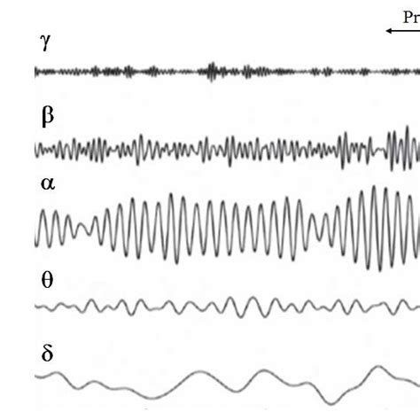 Eeg Signals In A Rest State With Closed Eyes Adapted From Figure 2 In