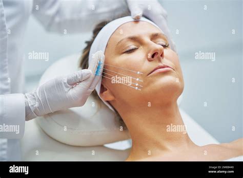 A Scene Of Medical Cosmetology Treatments Botulinum Injection Stock