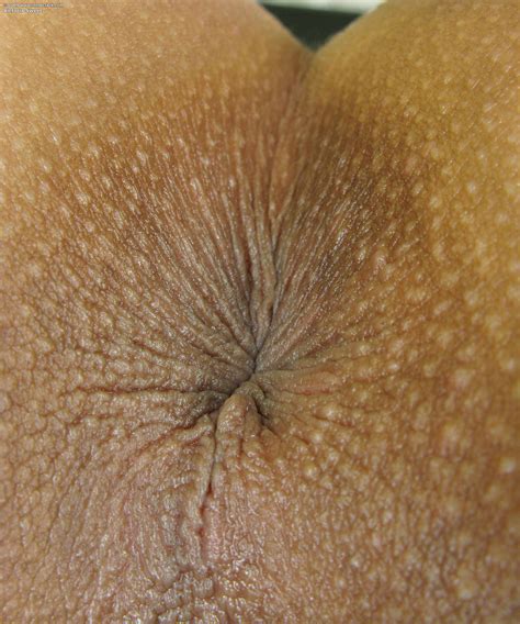 Skin Close Up Navel Flesh Porn Pic Eporner