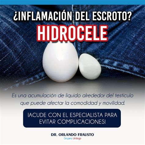 Dr Como Bien Se Sabe La Eyaculaciónprecoz En Los Hombres Se