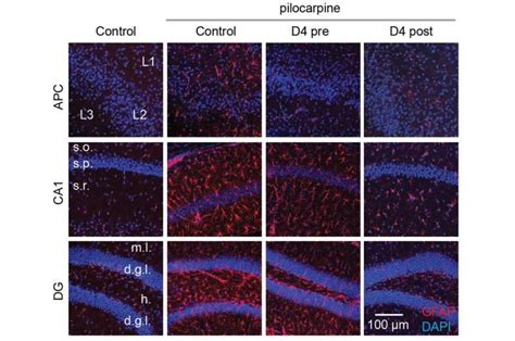 Neurocientistas Descobrem Um Novo Candidato A Medicamento Para O