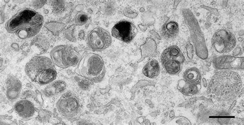 Image Gallery Biomedical Electron Microscopy Unit University Of