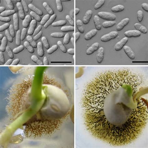 PDF Control Of Seed Borne Pathogens On Legumes By Microbial And Other Alternative Seed Treatments