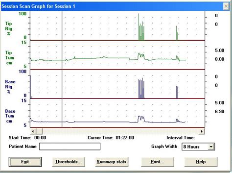 Test Con Il Rigiscan Plus Dott A Giambersio