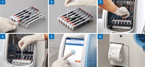 Phc Europe Introduces Two Reagent Kits At Analytica Medicalexpo E
