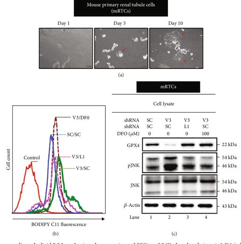Figure 1 From The Von Hippel Lindau Tumor Suppressor Gene Mutations