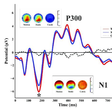 Hemianopic Patients A Visual Field Defect In Patient LF B Download Scientific Diagram