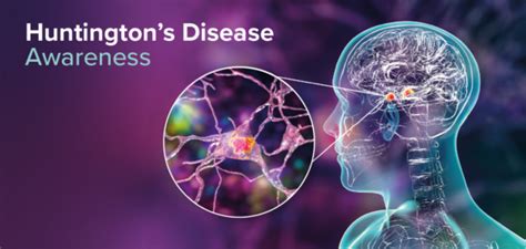 Hunting Down Huntingtons Disease Happiest Health