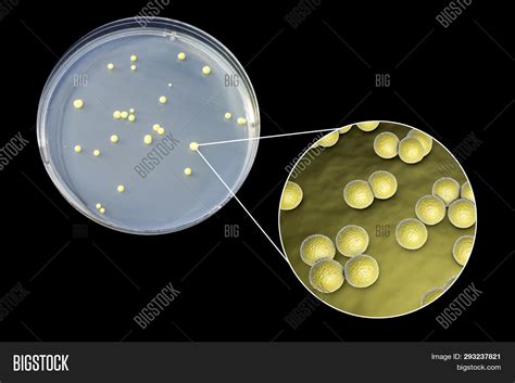 Colonies Micrococcus Image And Photo Free Trial Bigstock
