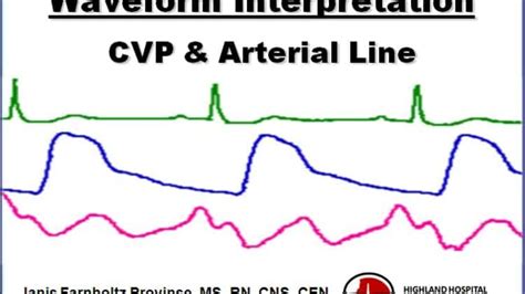 Cvp And Arterial Line Waveform Interpretation On Vimeo Arterial Line
