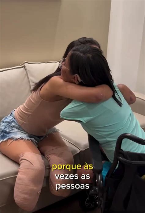 Quad Amputee Friends ThisVid Com Quad Amputee Friends ThisVid Com