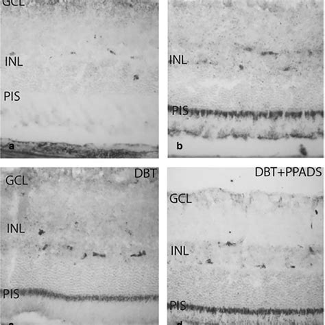 Retinal Cross Section Immunofluorescent Analyses Of Diabetic And
