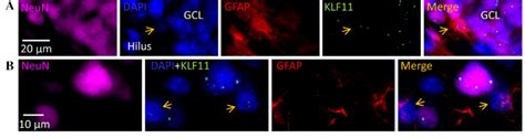 Nuclear Localization Of Klf11 In Neurons And Astrocytes Klf11